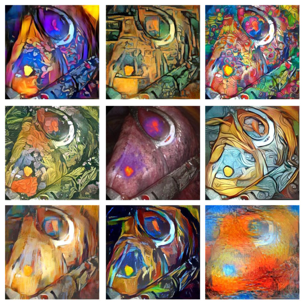 Terri Ann's Lung Cancer Story - She had zero symptoms